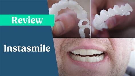 Best Temporary Pop-On Veneers for Front Teeth (2026) – Short-Term Top ...